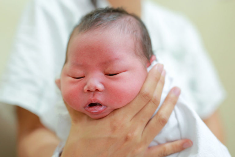 Reflux in Newborns - Breastfeeding Support